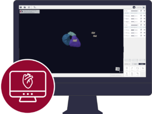 In silico trials with Virtonomy's product v-Patients - Virtonomy.io