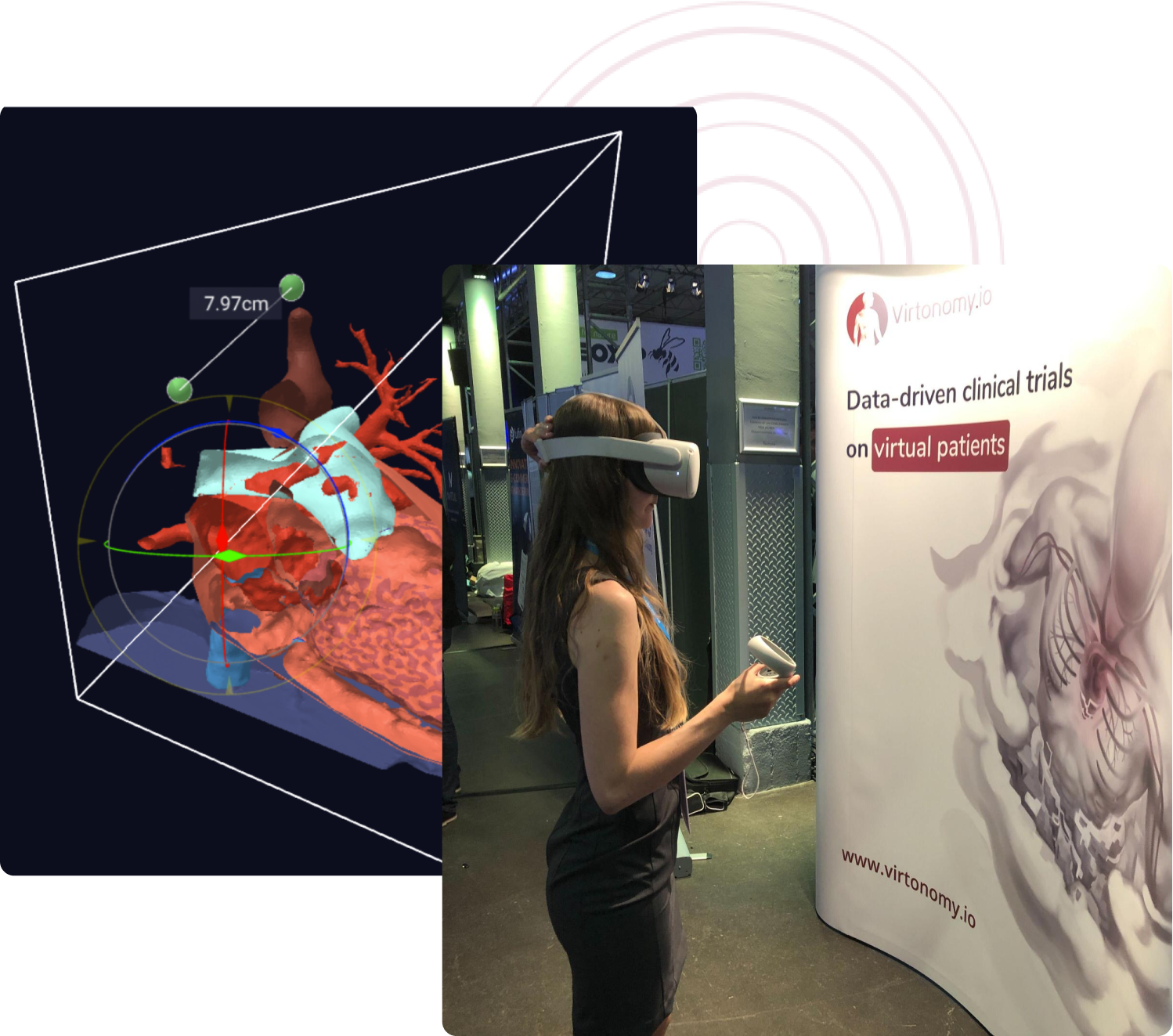 In silico trials with Virtonomy's product v-Patients - Virtonomy.io