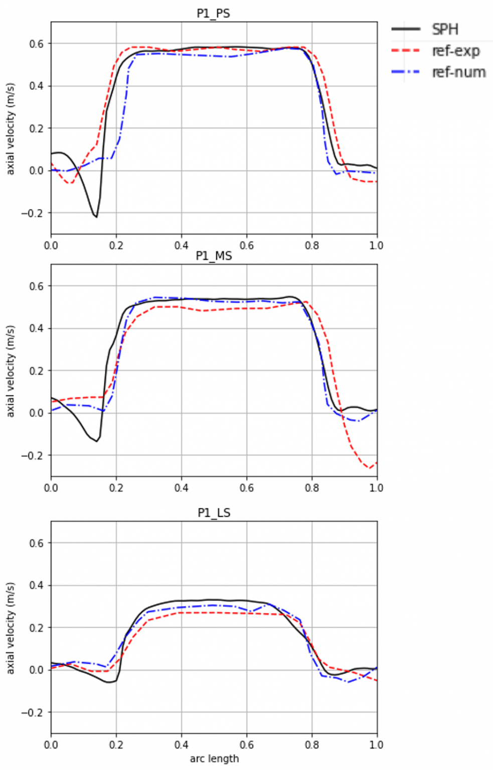 Aortic Valve Benchtop Done In Silico Using Medical Simulation ...