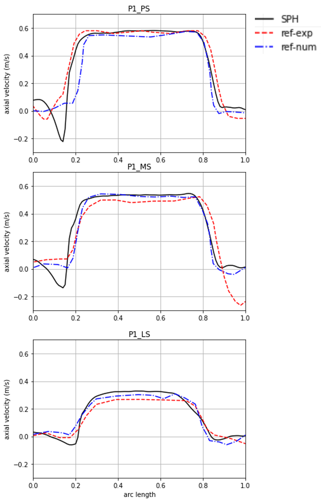 Aortic Valve Benchtop Done In Silico Using Medical Simulation - Virtonomy.io