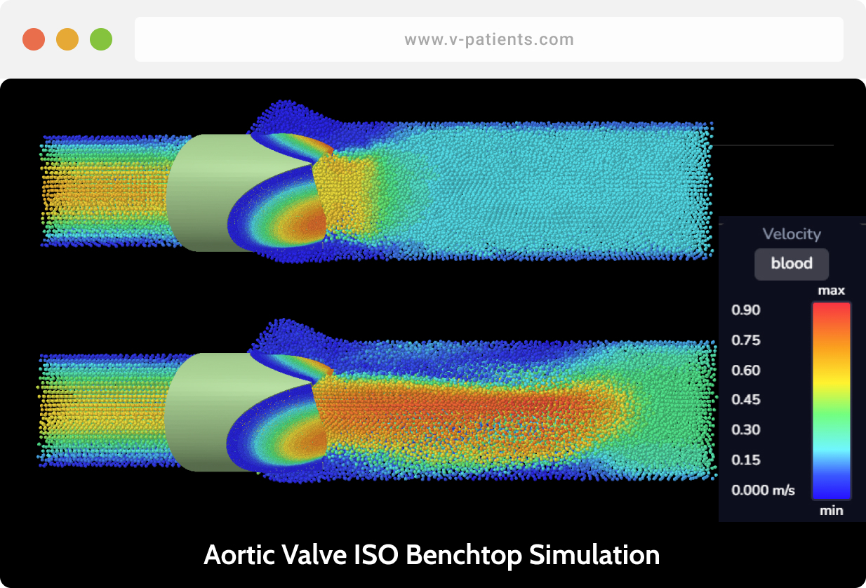 In silico trials with Virtonomy's product v-Patients - Virtonomy.io