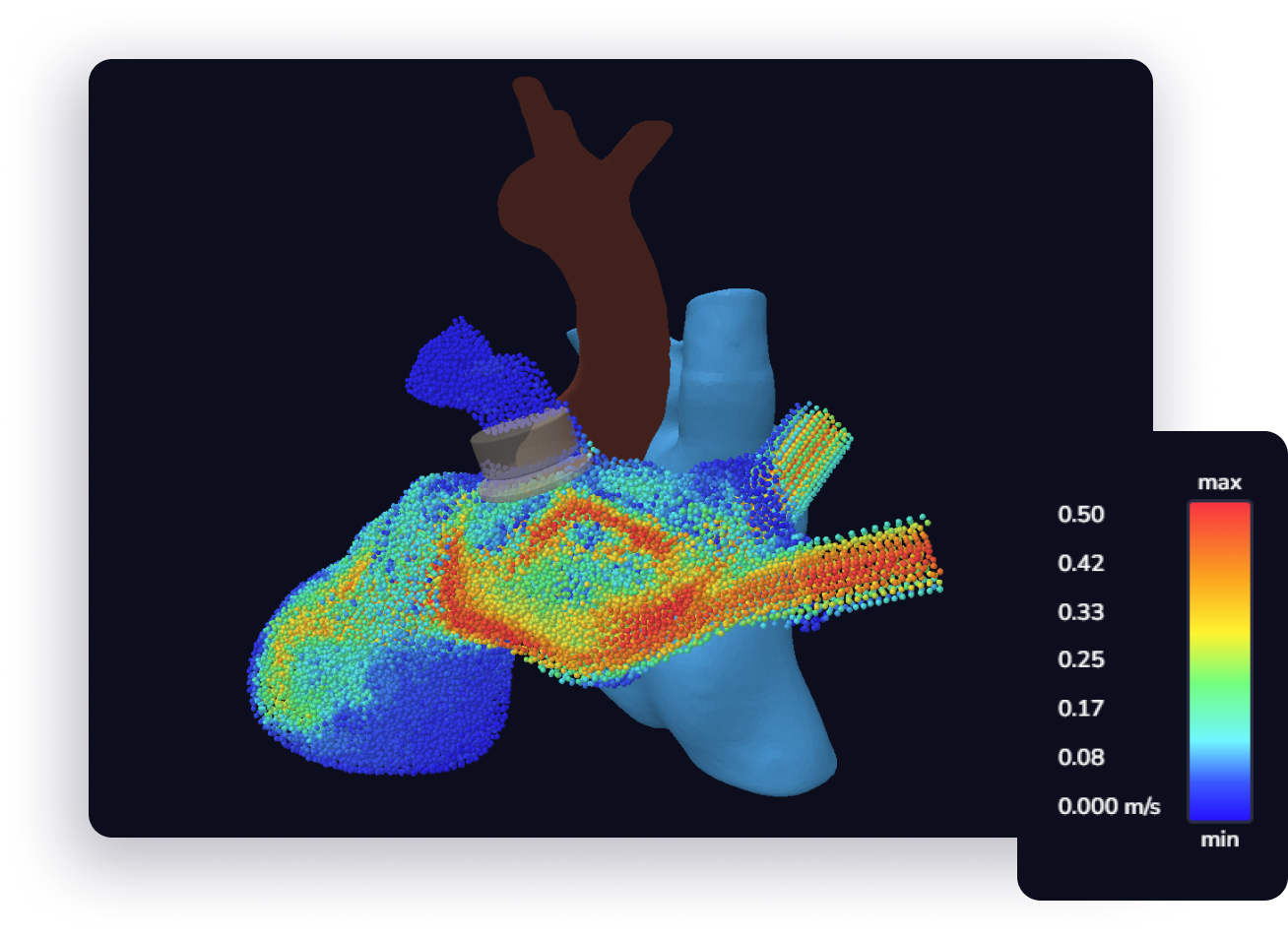 In silico trials with Virtonomy's product v-Patients - Virtonomy.io