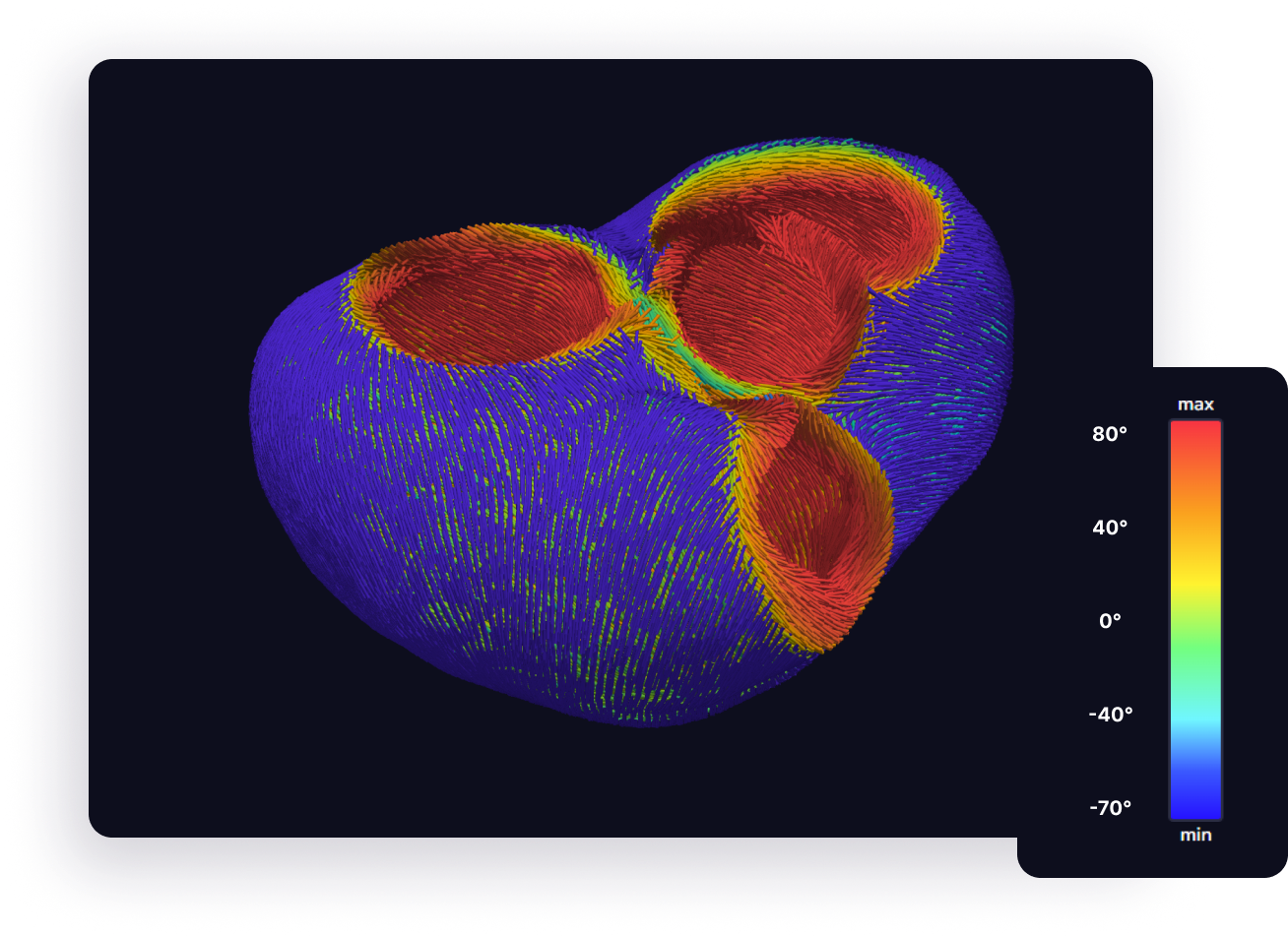 In silico trials with Virtonomy's product v-Patients - Virtonomy.io