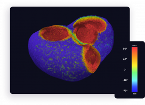In silico trials with Virtonomy's product v-Patients - Virtonomy.io