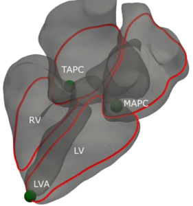 Virtonomy.io - Data driven clinical trials on virtual patients