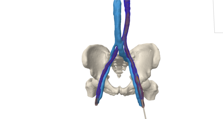 Virtonomy.io - Data driven clinical trials on virtual patients