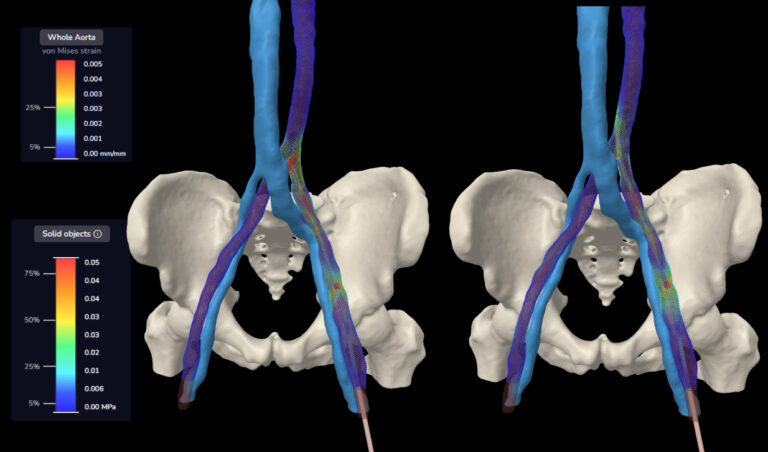 In silico trials with Virtonomy's product v-Patients - Virtonomy.io